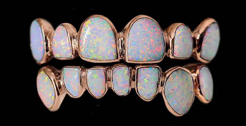 Opal Grillz Set – GoldTeethUSA: New York City's number one destination ...
